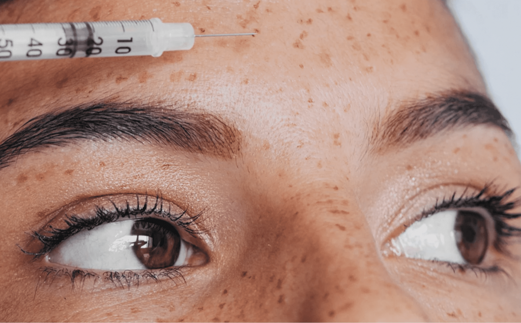 What You Need To Know About ‘Baby’ Botox - Dr. Sibthorpe featured in ...